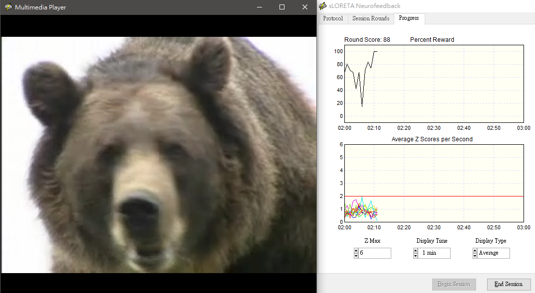 NeuroGuide｜神經回饋訓練｜資料庫｜QEEG 分析報告｜腦電波訊號收錄