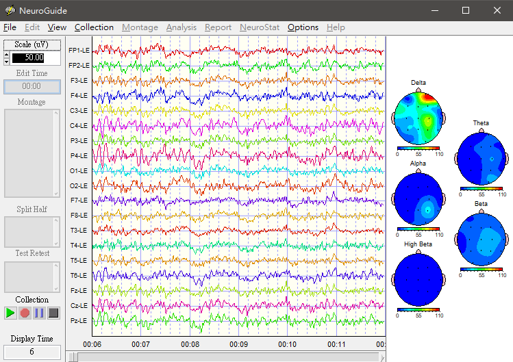 NeuroGuide｜神經回饋訓練｜資料庫｜QEEG 分析報告｜腦電波訊號收錄
